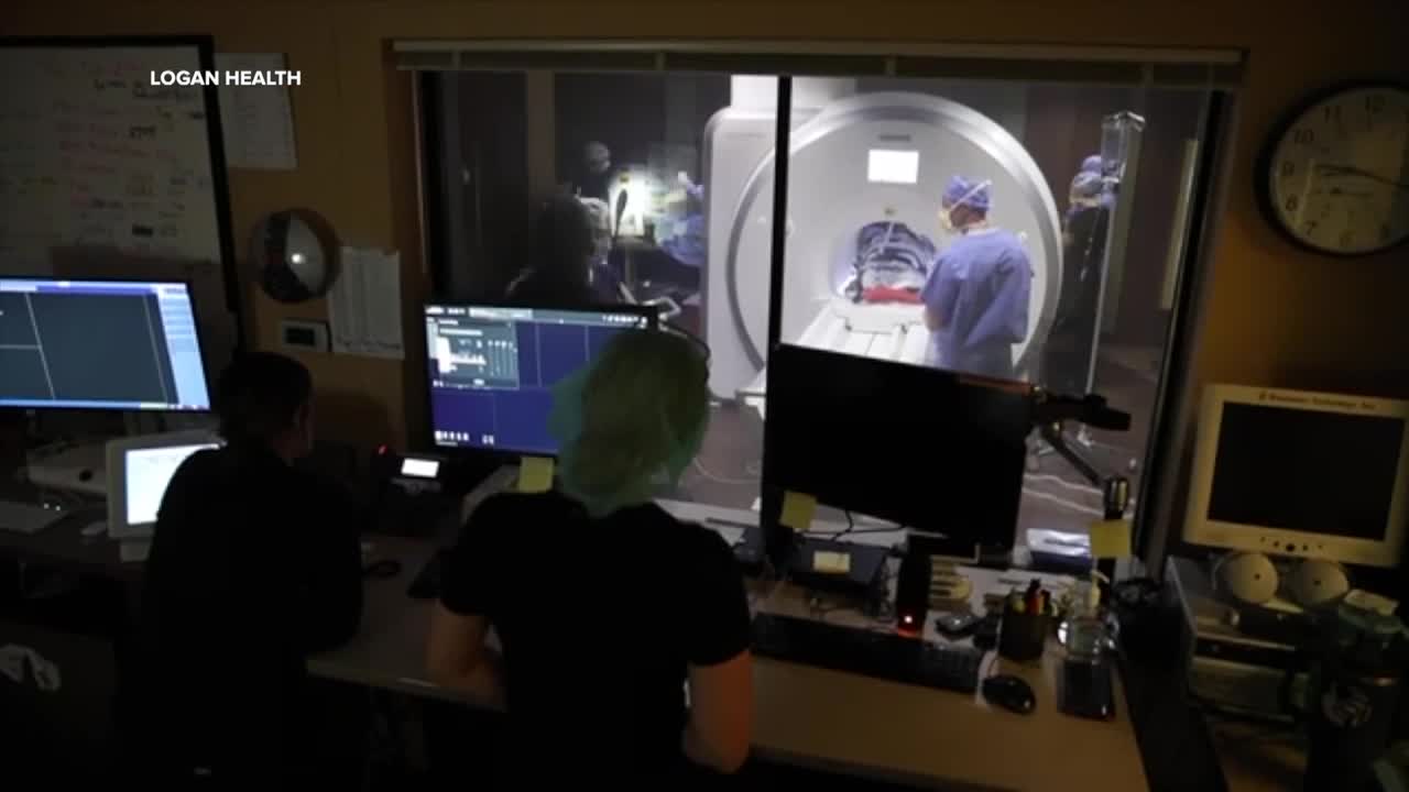 Logan Health performs Montana’s first minimally invasive brain tumor ...