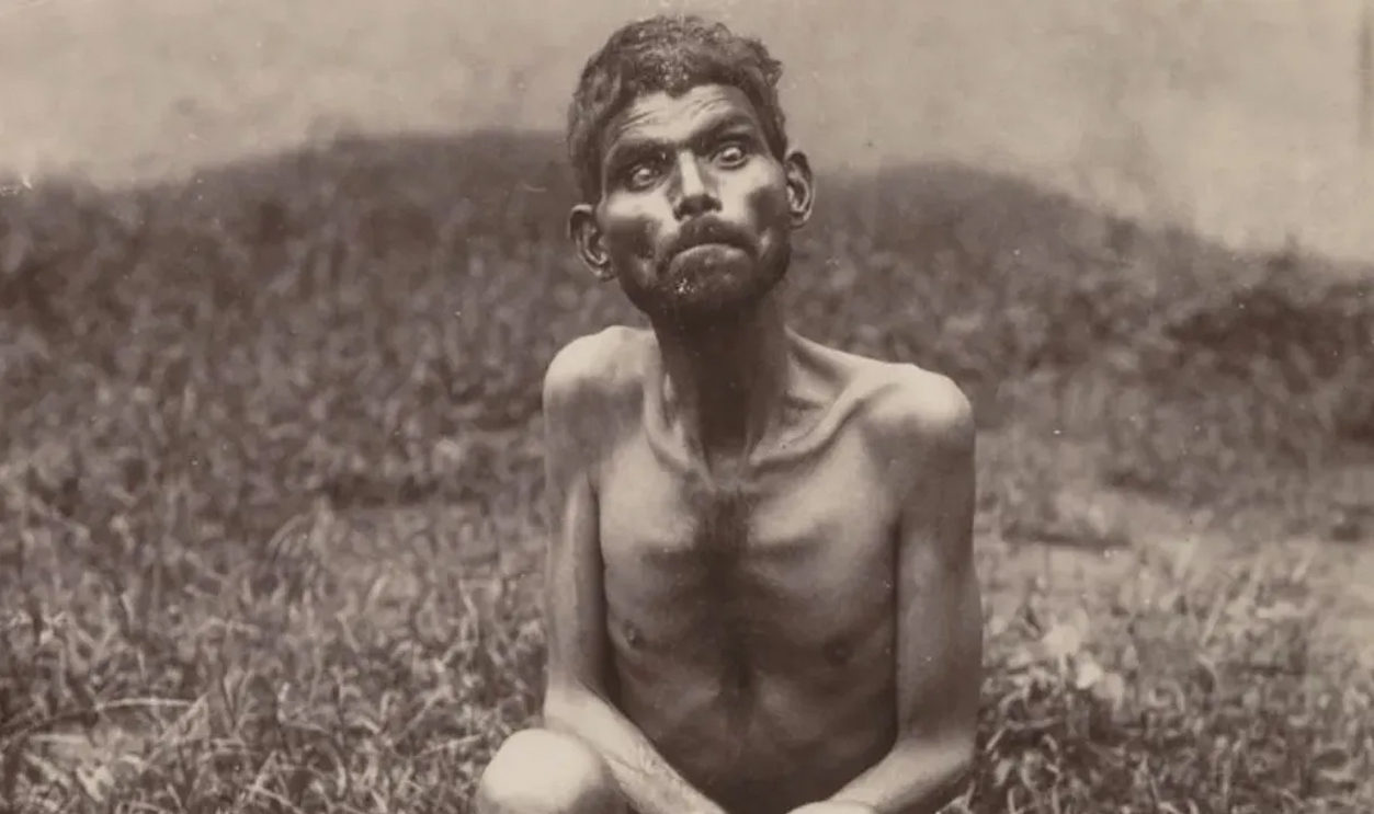 The Inspiring Story Of The Boy Who Was Raised By Wolves