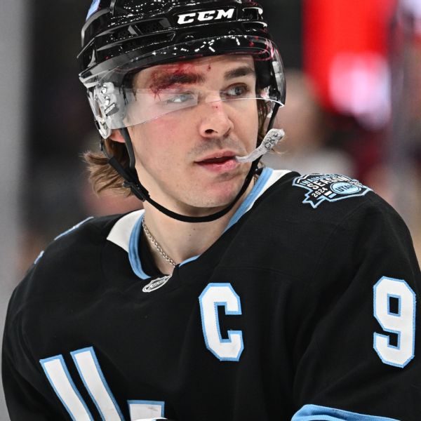 Utah's Keller returns, scores after getting struck by puck