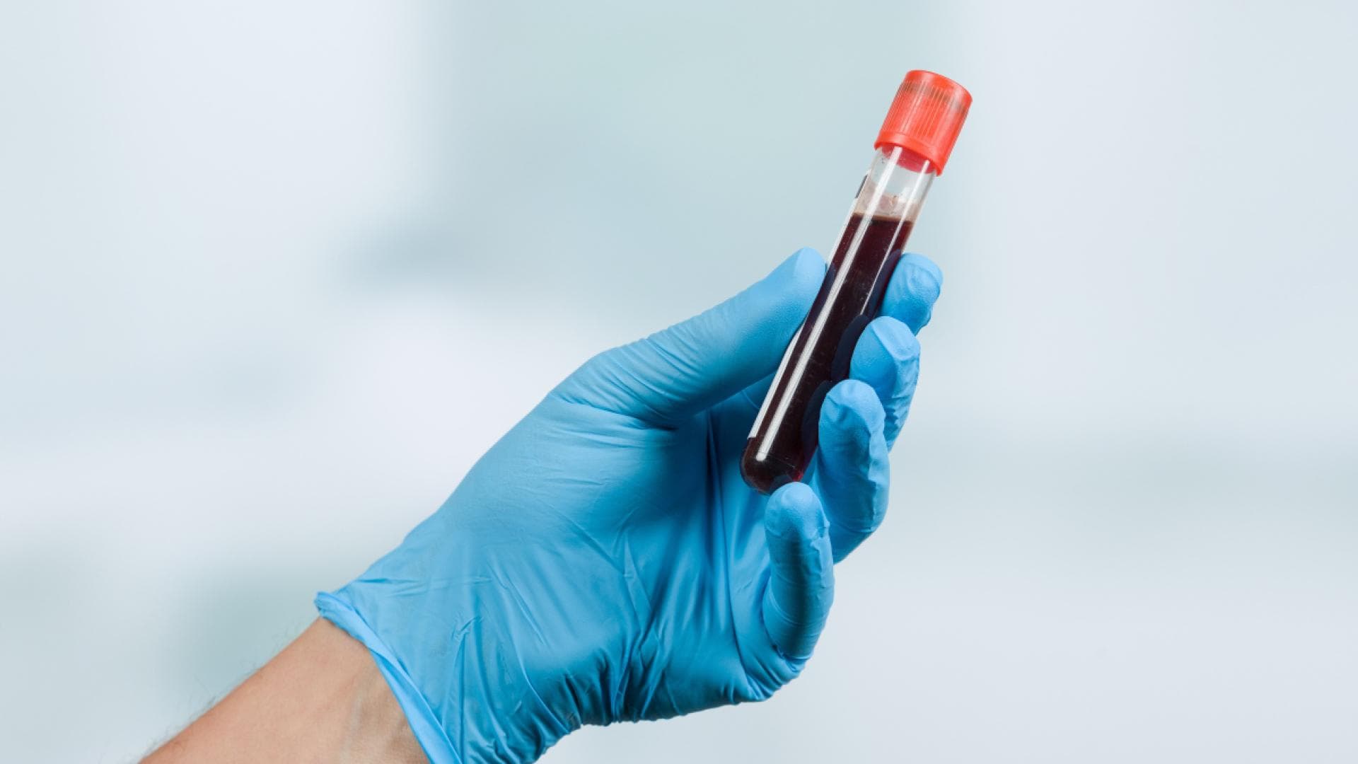 Studie: Einfacher Bluttest kann sechs Krebsarten erkennen