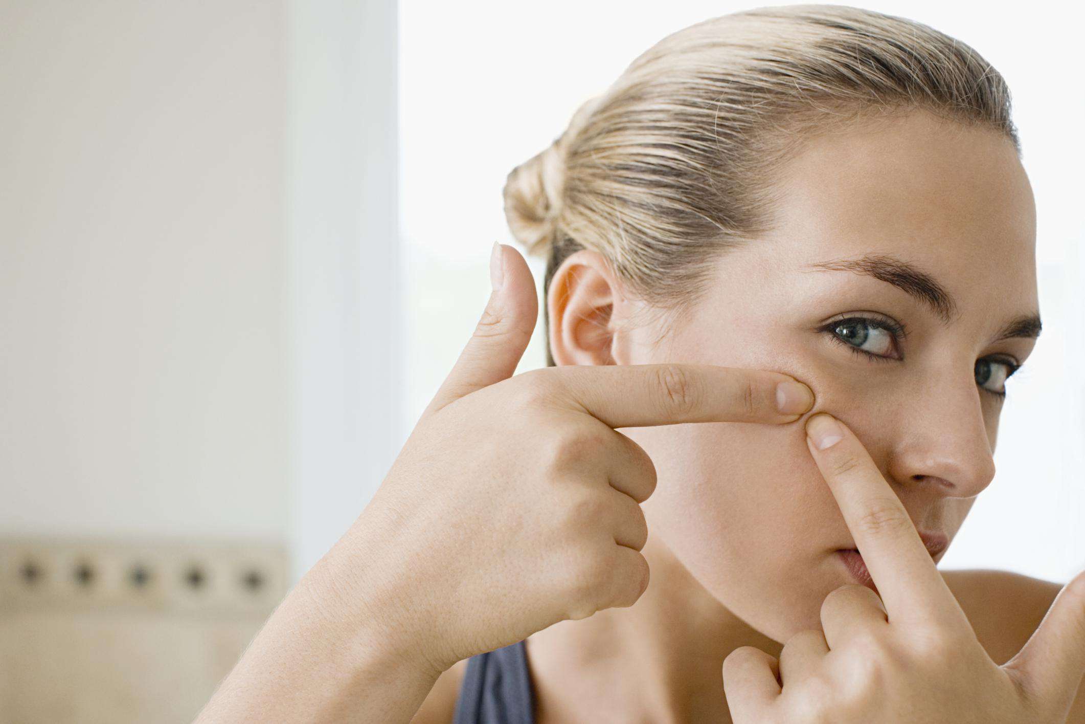Is Popping Pimples Bad for Your Skin?