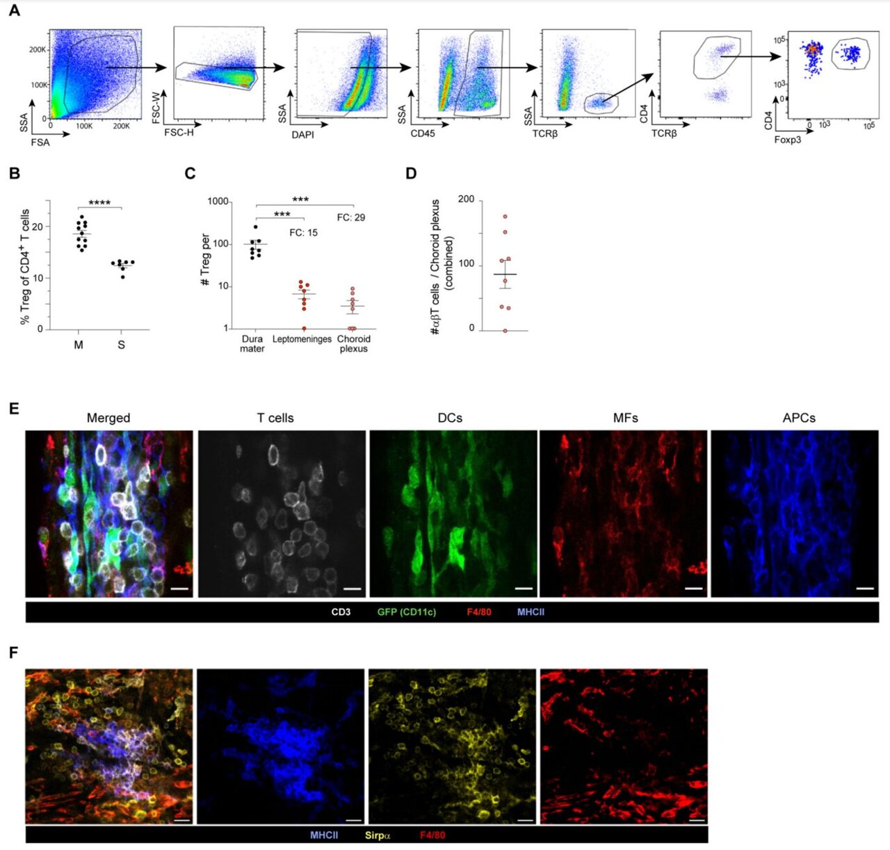 Regulatory T cells found to safeguard brain health and memory formation