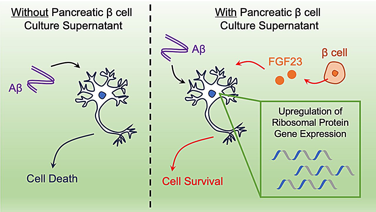 Pancreas cells secrete neuroprotective factor, study finds