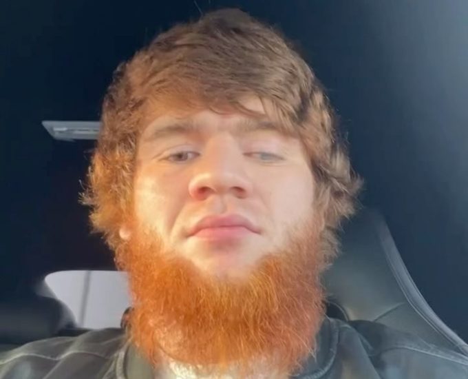 O que aconteceu com o olho de Shara Magomedov? Entenda as dificuldades ...