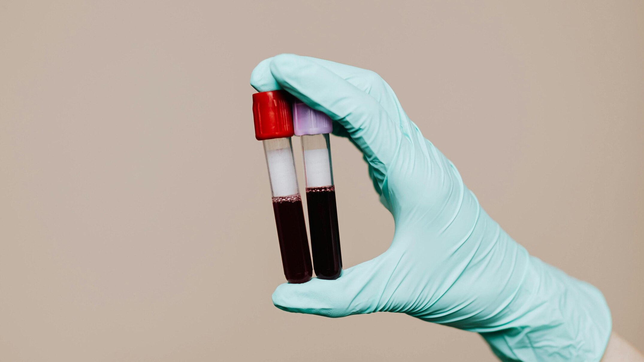 Health groups demand urgent ban on genetic discrimination in life insurance