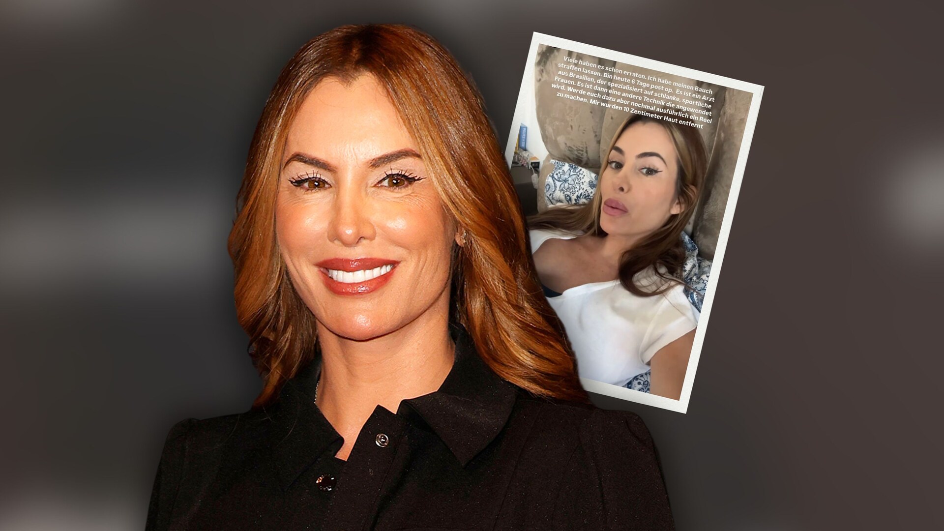 Anna-Maria Ferchichi lüftet Geheimnis um Schönheits-OP