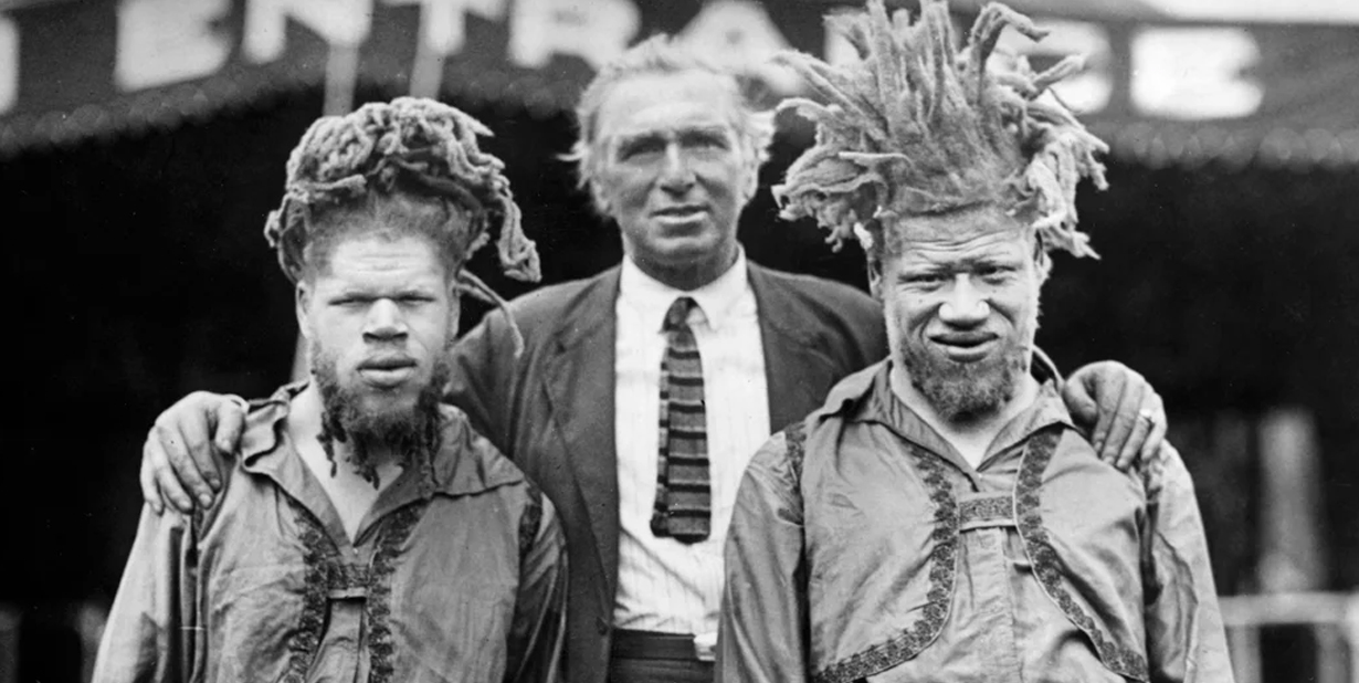 The Black Brothers Who Were Kidnapped By The Circus