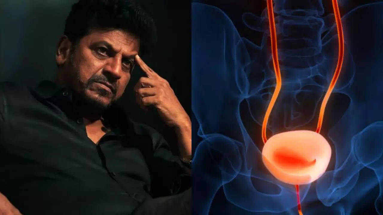 What Is Bladder Cancer That Kannada Actor Shiva Rajkumar Had? Know the First Signs of This ...