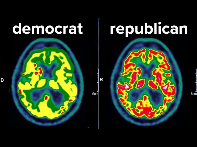 I Scanned A Democrat & Republican's Brains