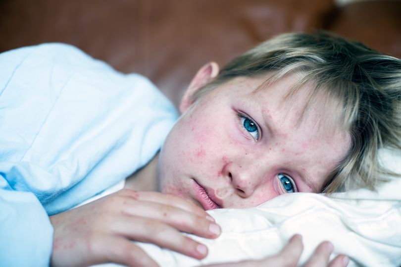 UK health chiefs issue alert over 'highly infectious' disease