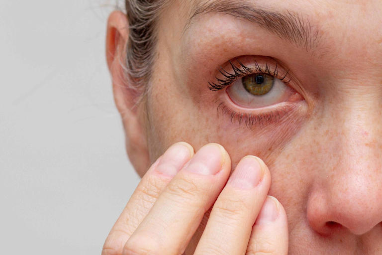 8 Reasons Why You Have Crusty Eyes, and What To Do About It