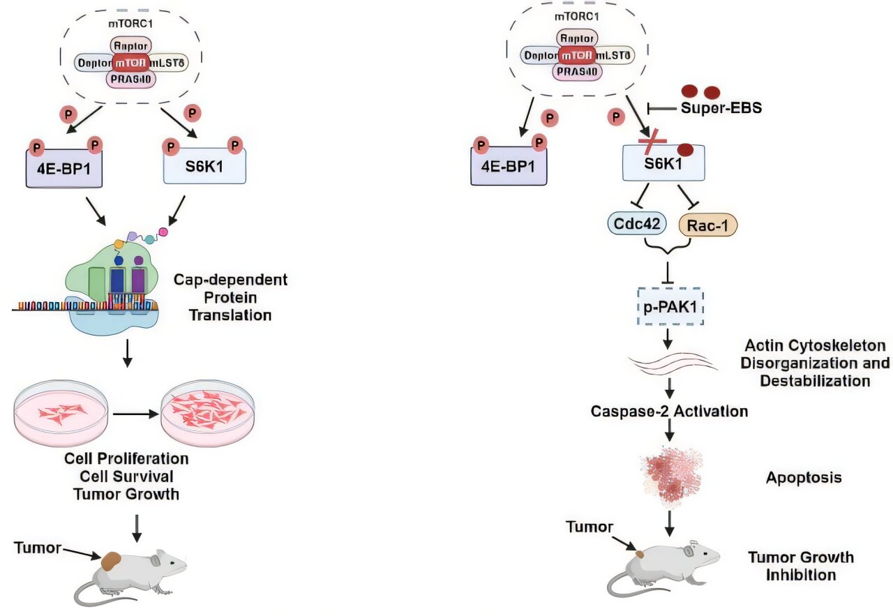 Study highlights new target and potential therapy for treatment ...