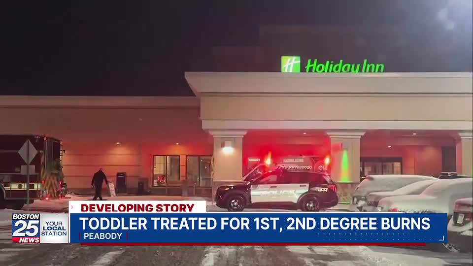 18-month-old treated for 1st, 2nd degree burns after cooking incident ...