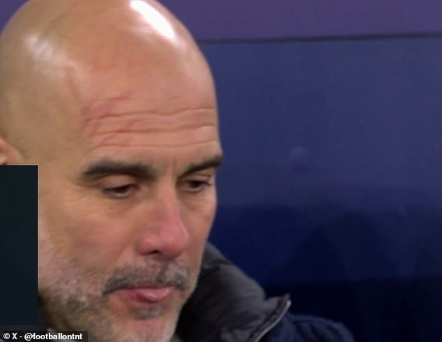 Pep Guardiola spotted with scratches on his head AGAIN as his ...