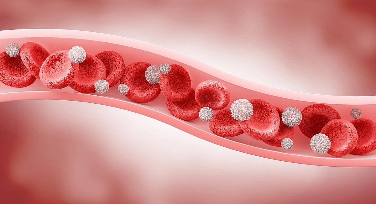 Long COVID Severity Linked to White Blood Cell Count