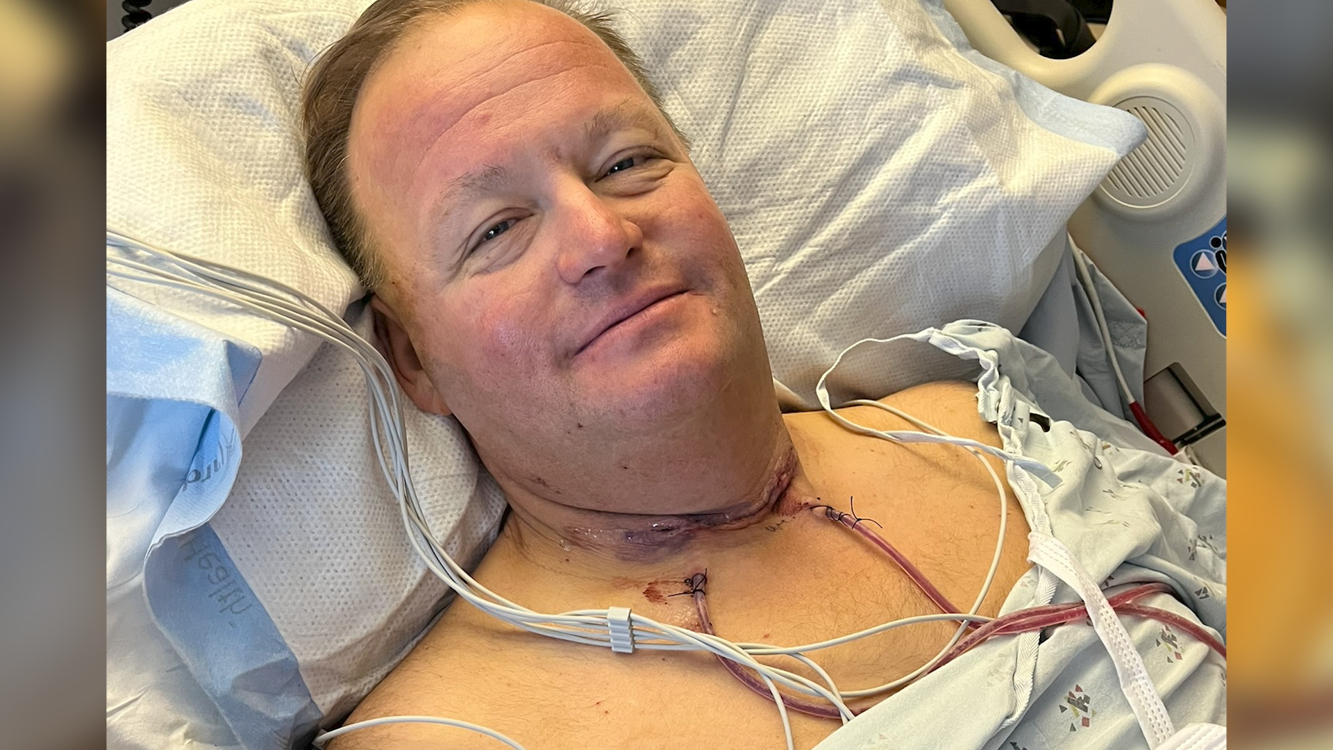 'Wouldn't be alive today': Papillion man credits annual physical for ...