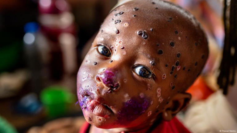 What is Distillation of AI Models: Explained in short