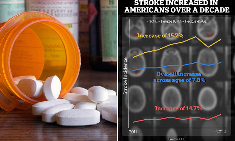 Researchers reveal common anxiety drug that lowers risk of stroke Researchers reveal common anxiety drug that lowers risk of stroke
