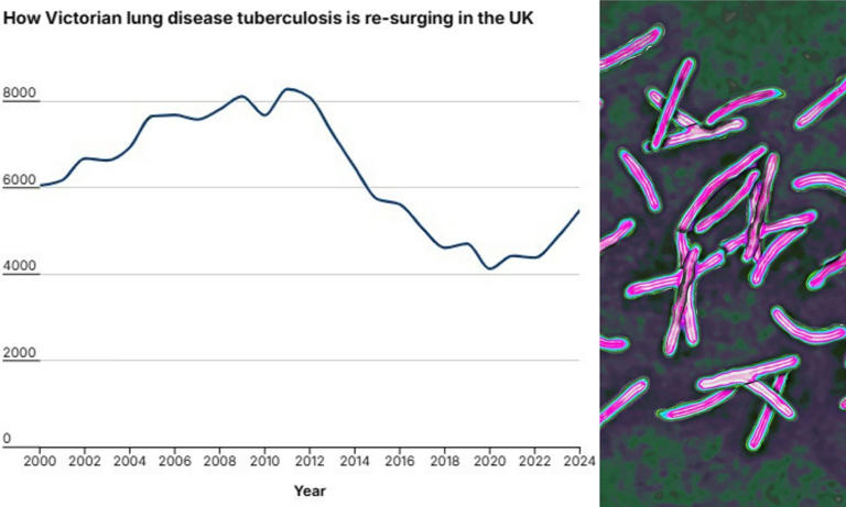 Victorian lung disease tuberculosis surges in the UK