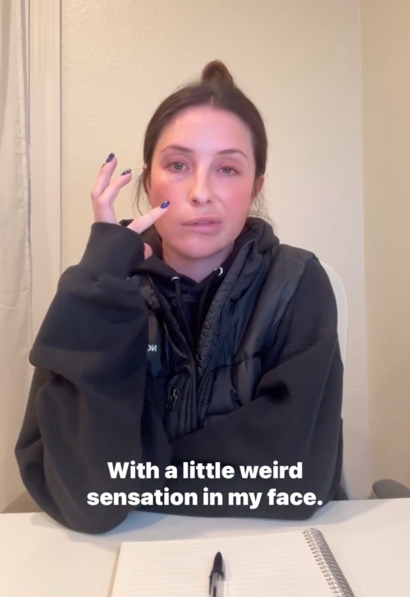 Bristol Palin reveals ‘crazy’ facial paralysis photos from neurological ...