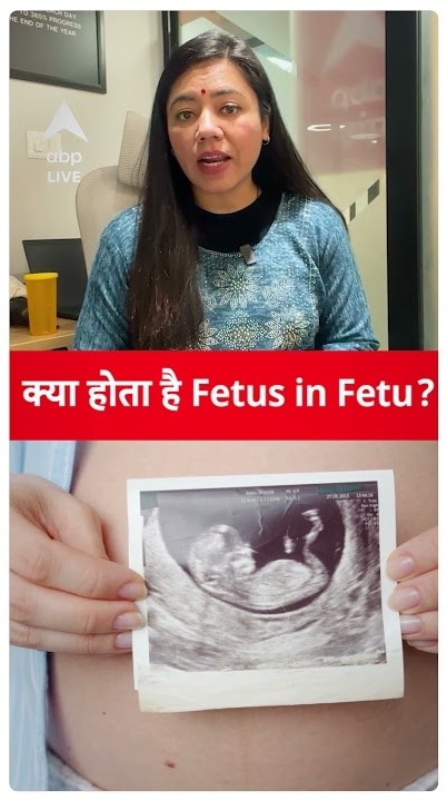 Rare Case Of Fetus In Fetu Reported In Maharashtra, Shocking Doctors ...
