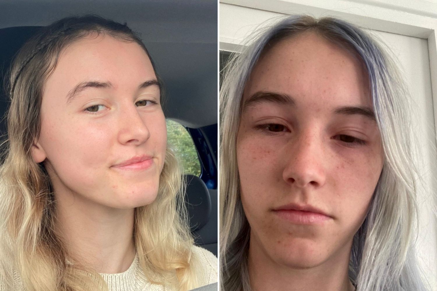 I'm allergic to more than 40 things including water