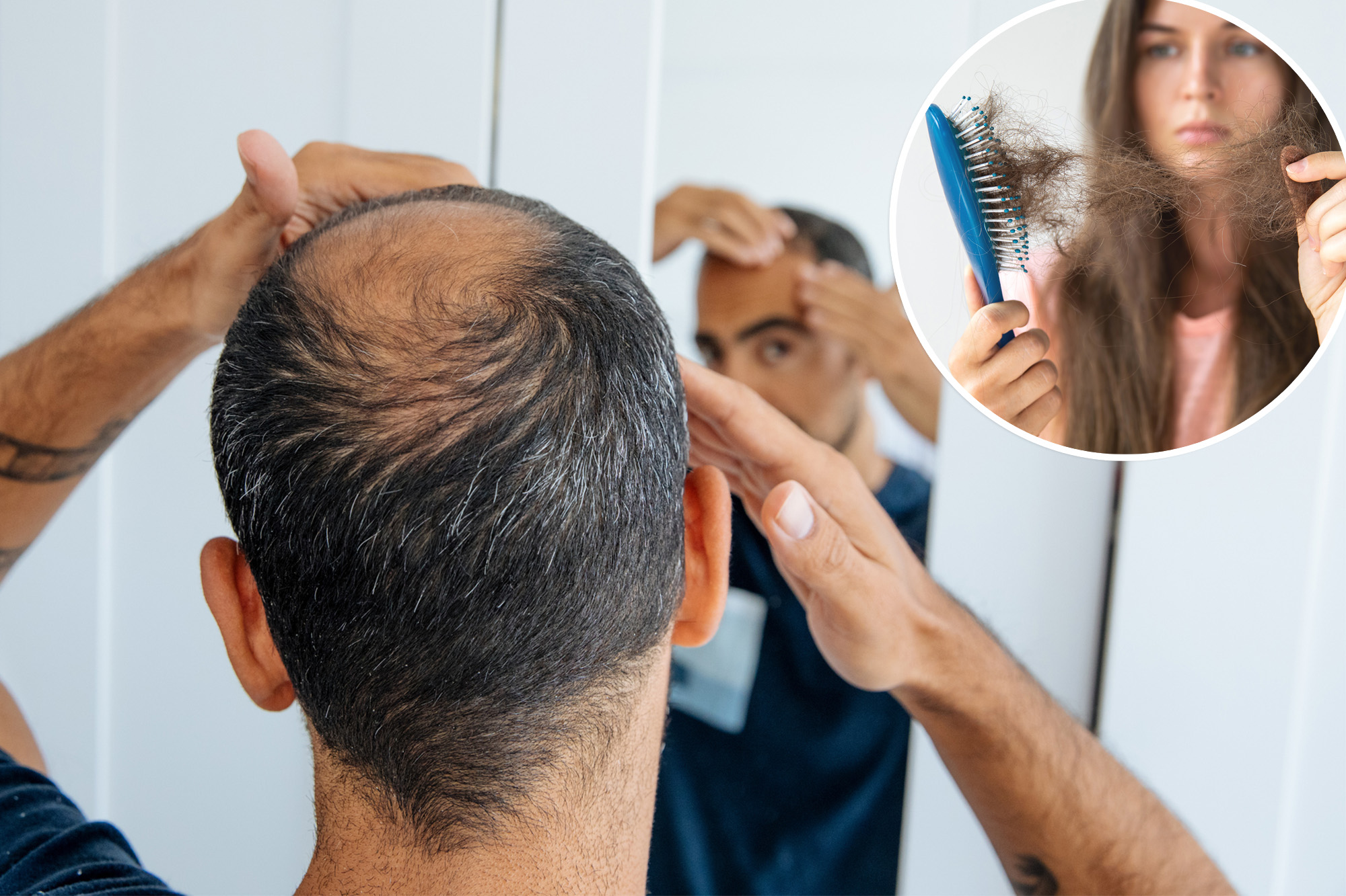 New treatment for hair loss shows promise — paid volunteers needed to ...
