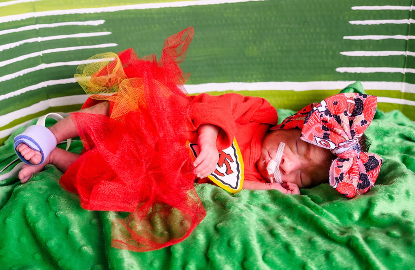 PICTURES: Babies at MU Health Care’s NICU ready for Super Bowl 59