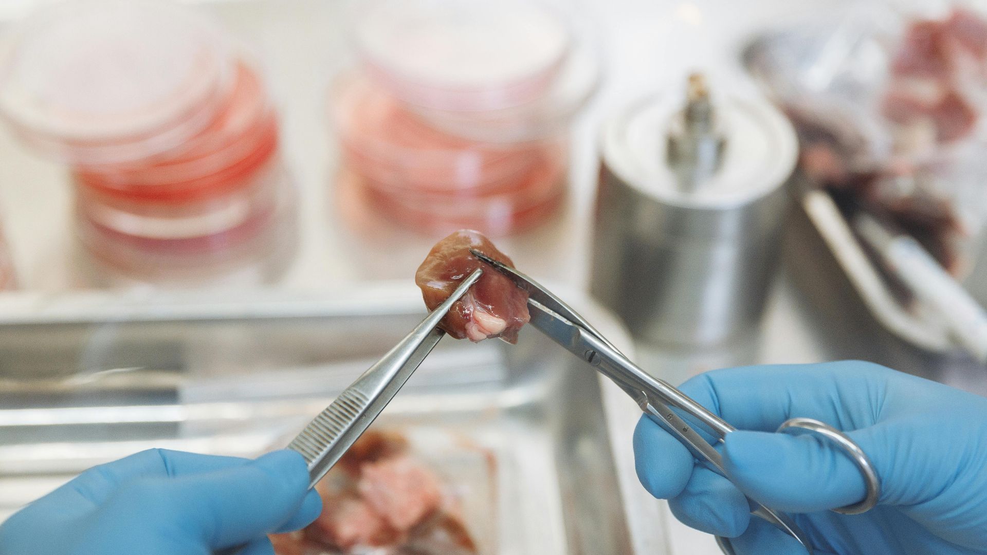 Lab-Grown Meat? 10 Drawbacks You Should Know About & 10 Potential Benefits