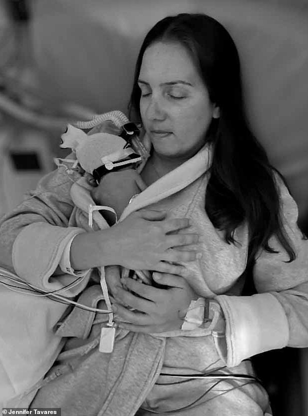 My common pregnancy symptom got so bad I delivered nine weeks early