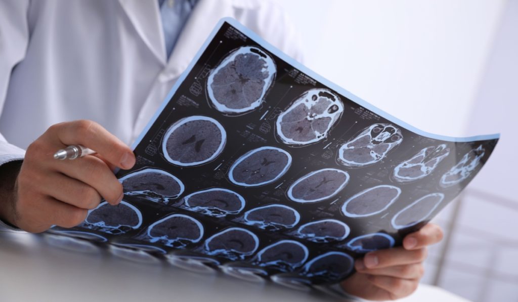 Scott Hamilton Gives Cancer Update