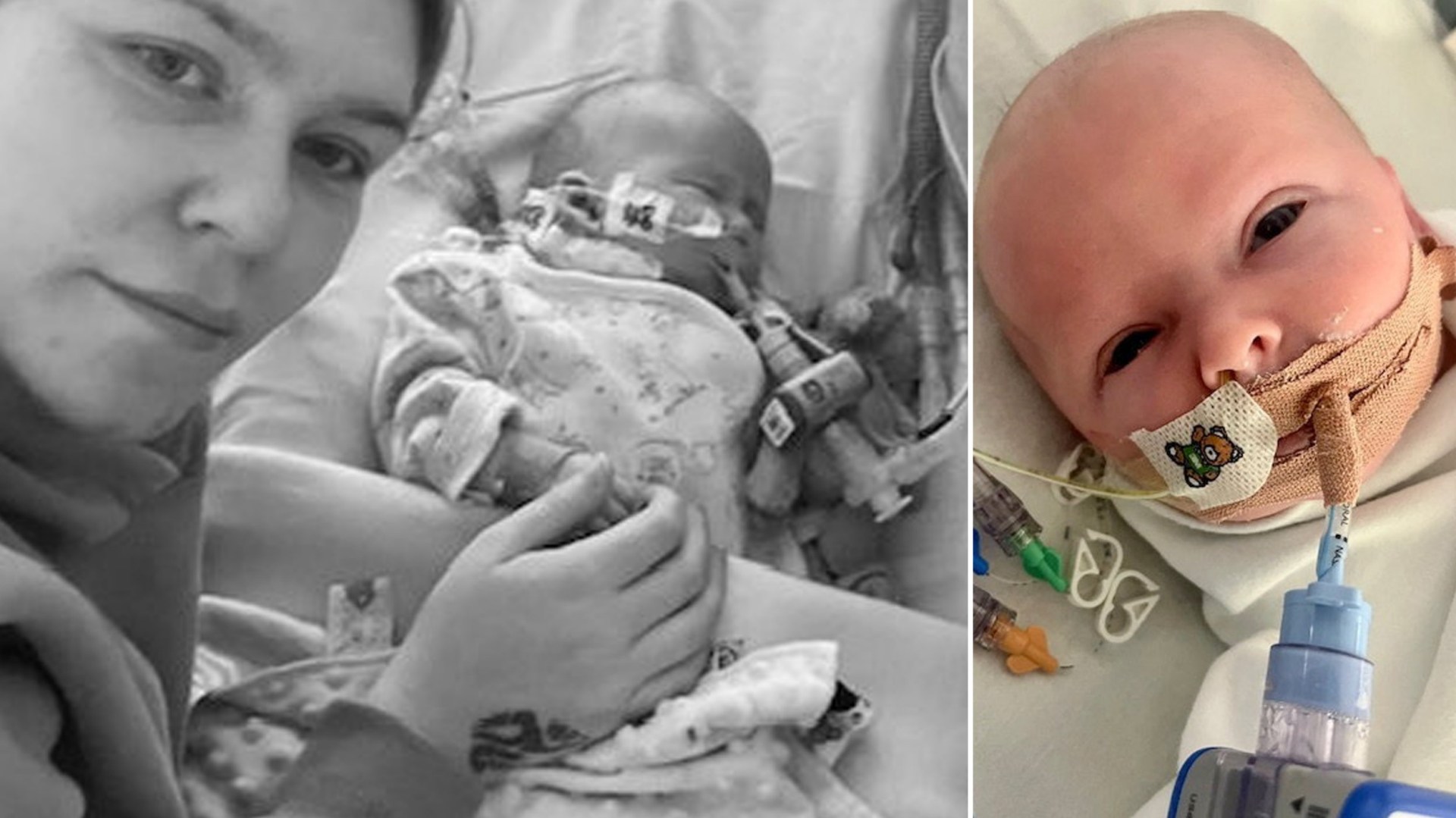 Baby born with cloudy eyes is one of just 23 in world with rare genetic ...