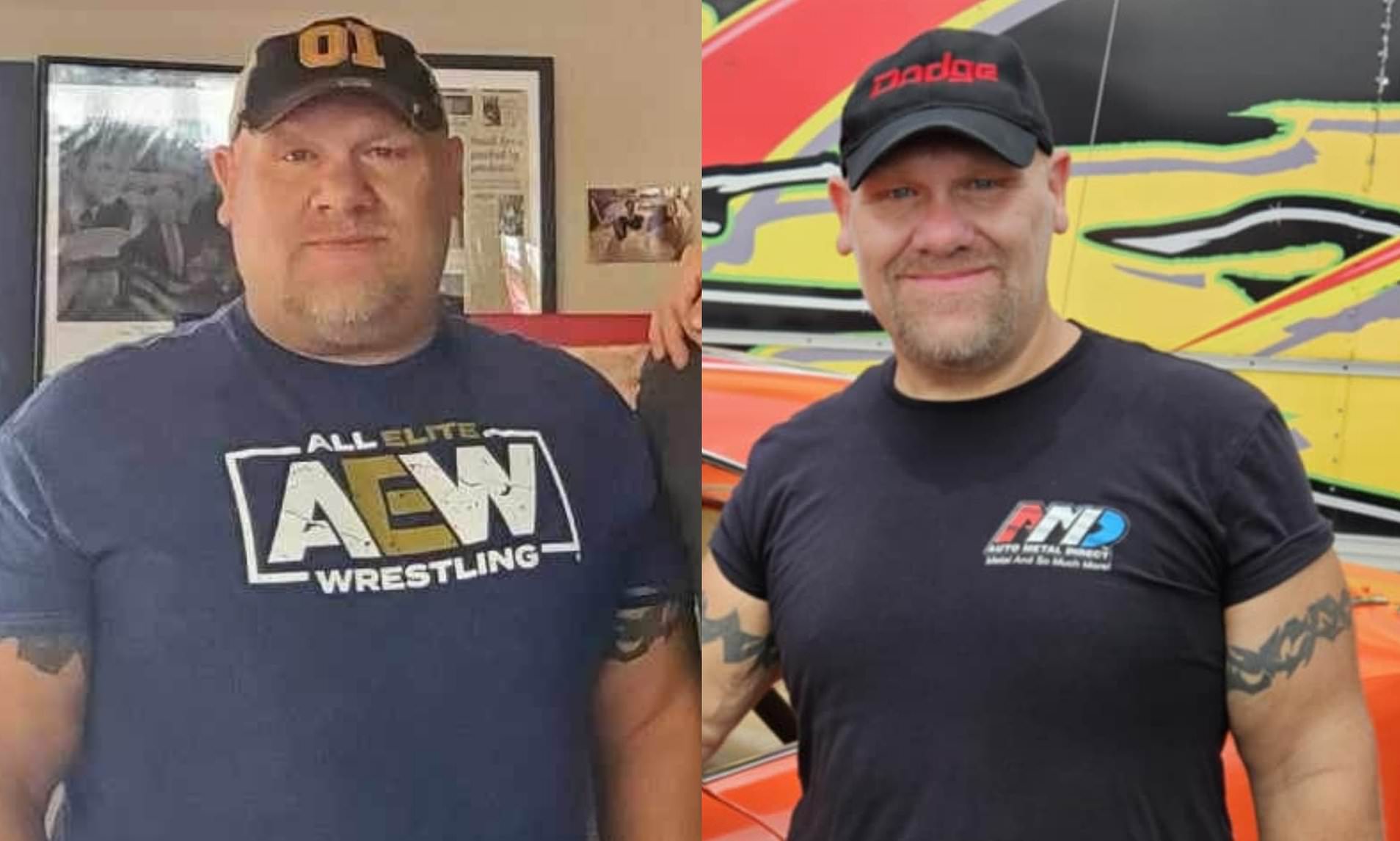 My head doubled in size- I felt freakish but doctor found deadly cause