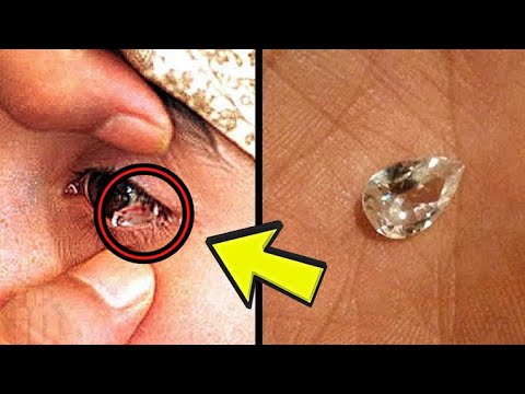 Little Girl Cries Tears of Crystal, Scientists Are Shocked by How Much ...