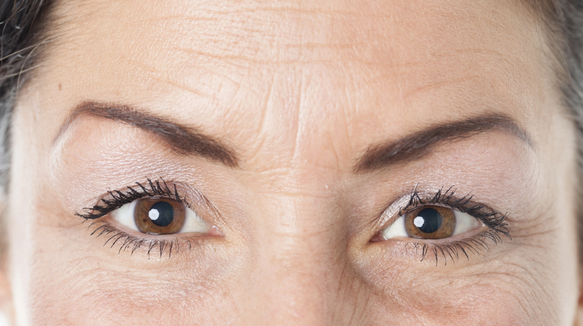 Wrinkles Are One of the Biggest Concerns About Aging – Here’s How to ...