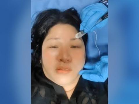 Frenchie Dy gives update on her Bell's Palsy