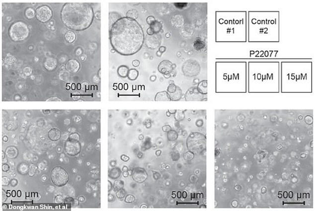 Cancer breakthrough as scientists discover 'switch', reverse disease
