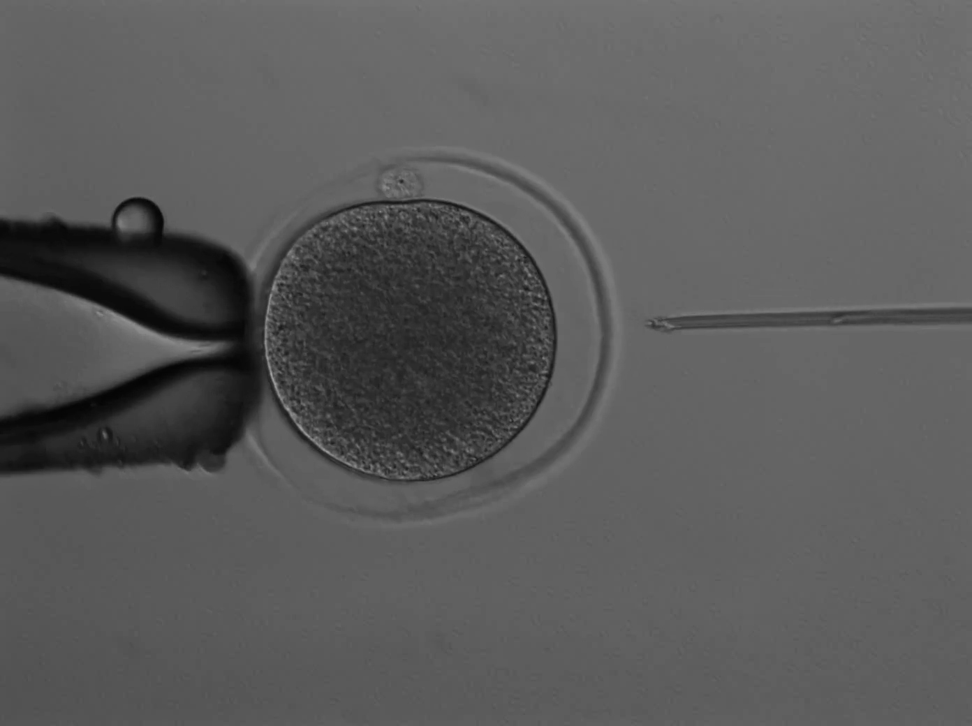 RAW VIDEO: Scientists Achieve First-Ever Kangaroo IVF Embryos In ...