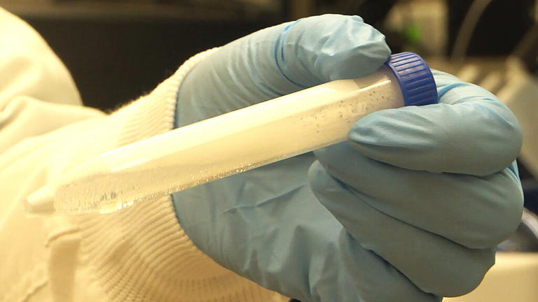 S.C.-invented treatment could transform burn care