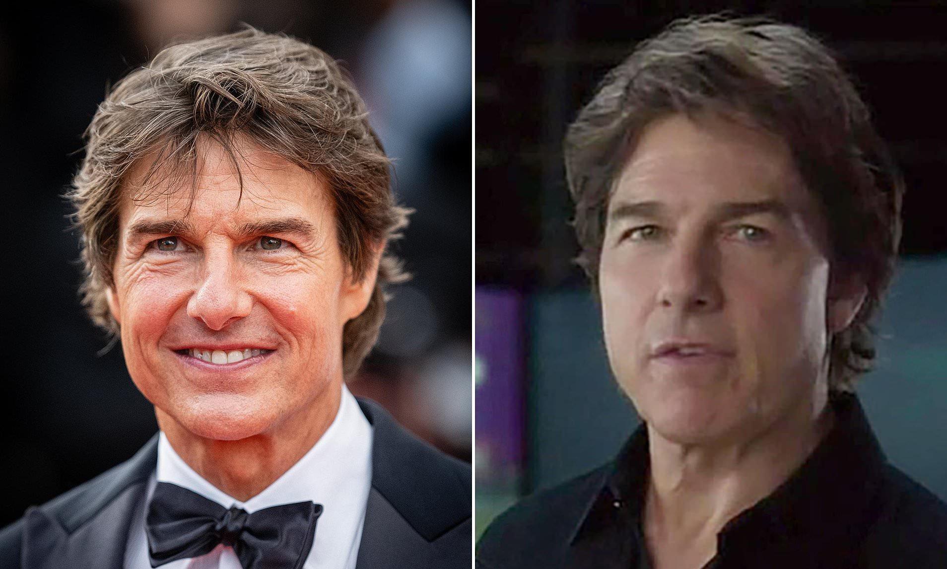 Experts weigh in on Tom Cruise's face after Super Bowl appearance
