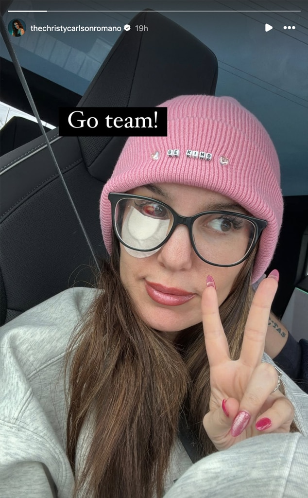 Christy Carlson Romano Shares New Photo of Her Eye After Getting Shot