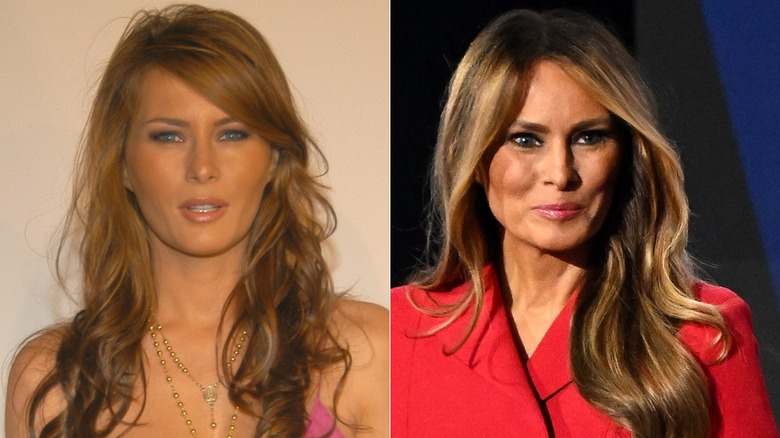 The Wildest Theories About Melania Trump's Rumored Plastic Surgery