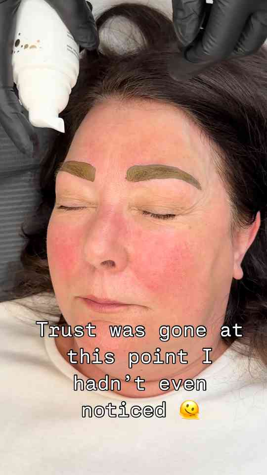 Client's Eyebrow Transformation Journey