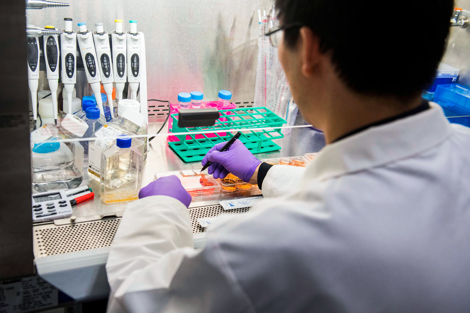 NIH cuts could stall medical progress for lifesaving treatments ...