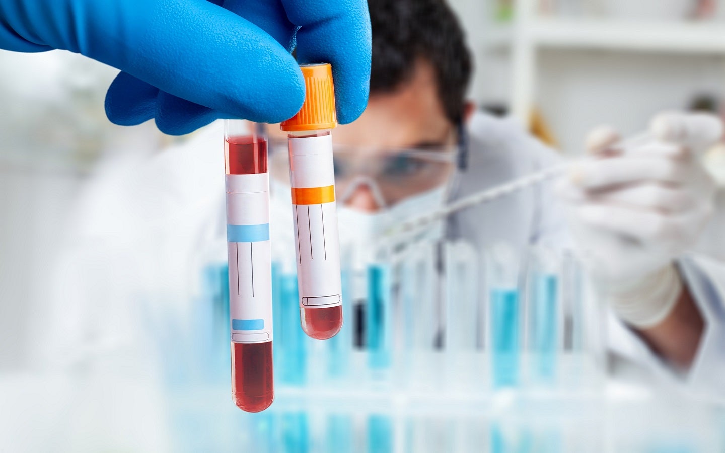 Amadix receives EIB financing to develop cancer detection blood tests