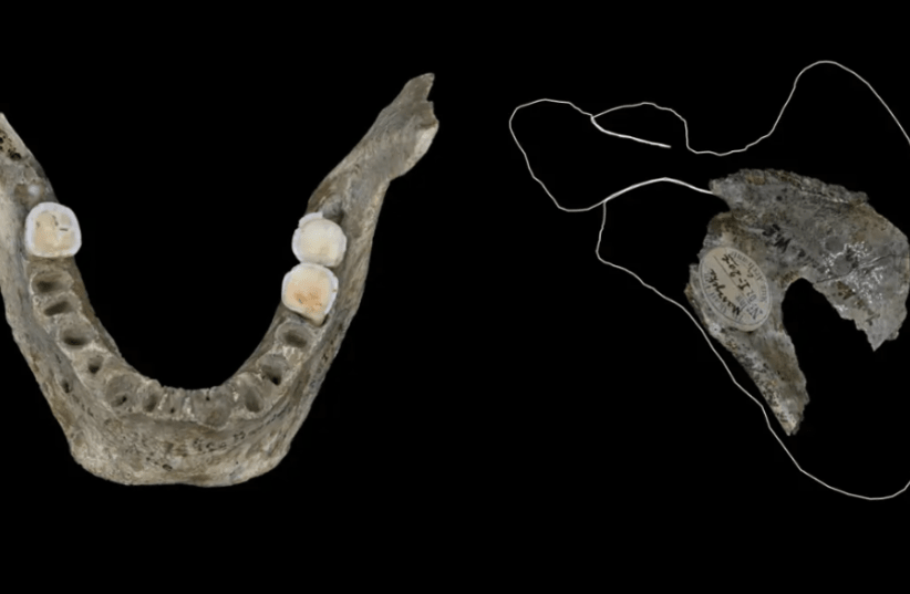 New evidence confirms prehistoric brain cannibalism in Poland's ...