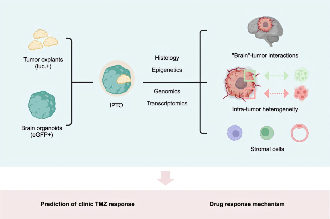 Patient-specific brain tumor models guide personalized treatment
