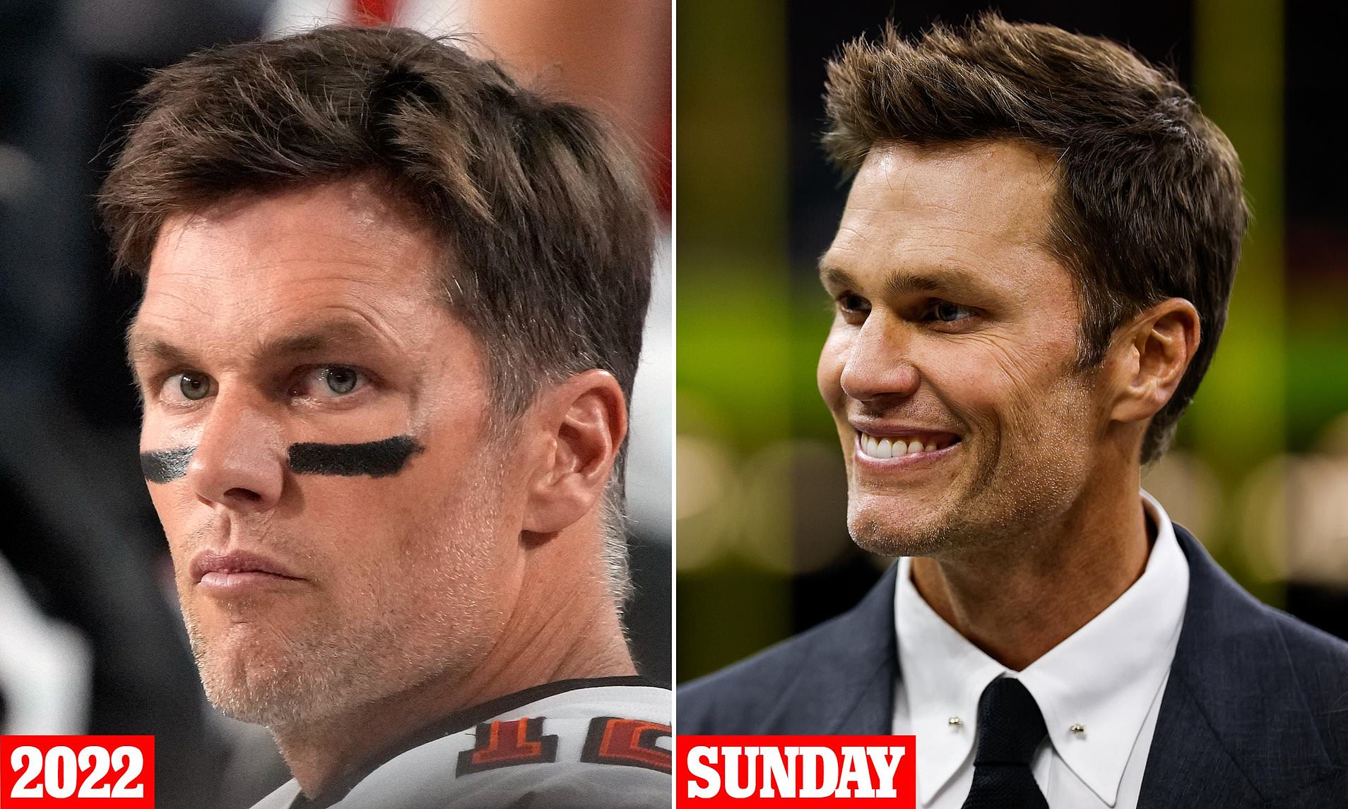 Plastic surgeons reveal why Tom Brady's face was 'gaunt' at Super Bowl