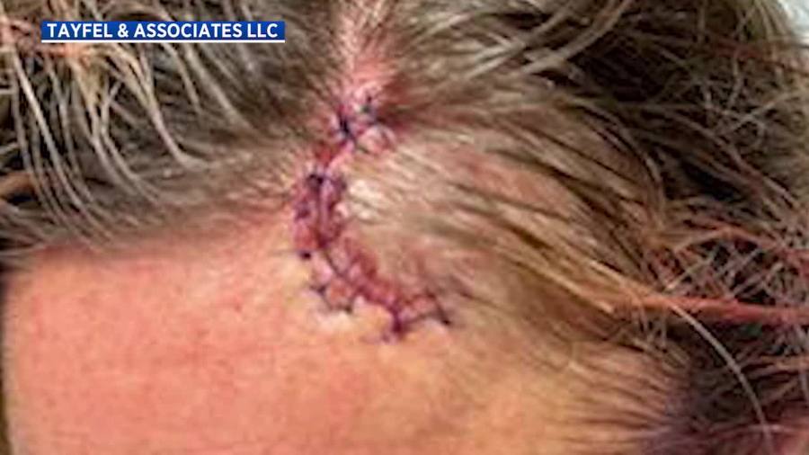 Akron woman sues Hulk Hogan, Real American Beer, for head injury