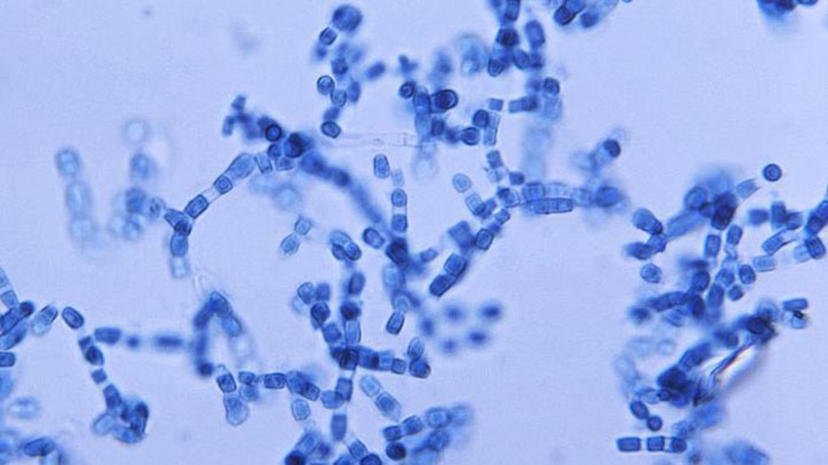 Flu numbers are improving in Mass., but hospitals are feeling the strain